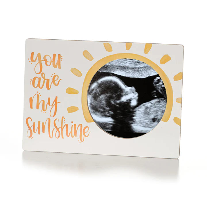 You are my Sunshine Magnetic Ultrasound Frame – Picture Perfect Baby, LLC